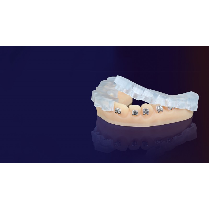 KeyPrint Ortho IBT, Keystone